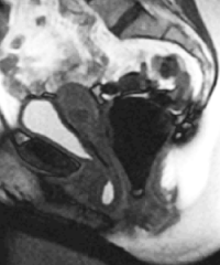 Mri GIFs - Get the best gif on GIFER