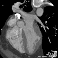 Ct GIFs - Get the best gif on GIFER