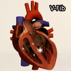 Cardiology GIFs - Obtenez le meilleur gif sur GIFER