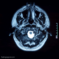 Mri GIFs - Get the best gif on GIFER