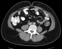 Pet scan GIFs - Get the best gif on GIFER