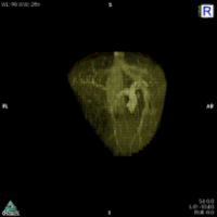 Liver GIFs - Get the best gif on GIFER