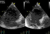 Ultrasound GIFs - Get the best gif on GIFER