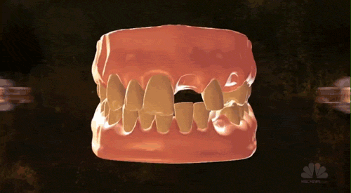 Dentistry GIFs - Get the best gif on GIFER