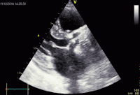 Ultrasounds GIFs - Get the best gif on GIFER